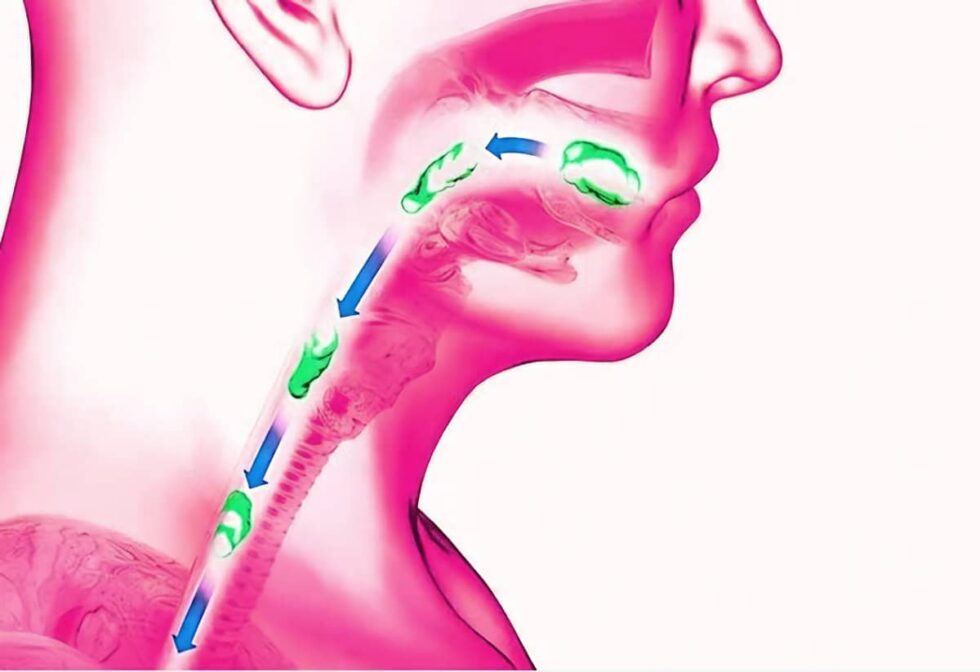 ¿Qué es la DEGLUCIÓN ATÍPICA? 🥇 | Logopedia y Más